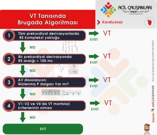 Brugada Algoritması | Acil Çalışanları