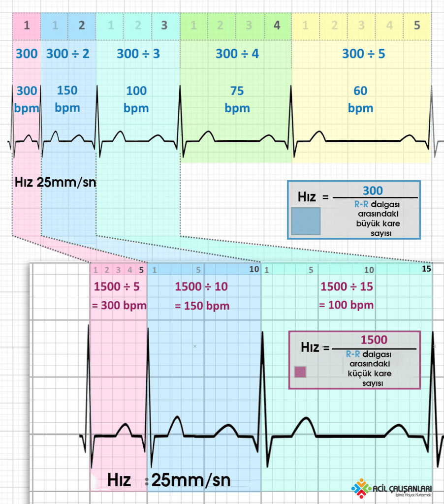 EKG Yorumlama - Acil Çalışanları