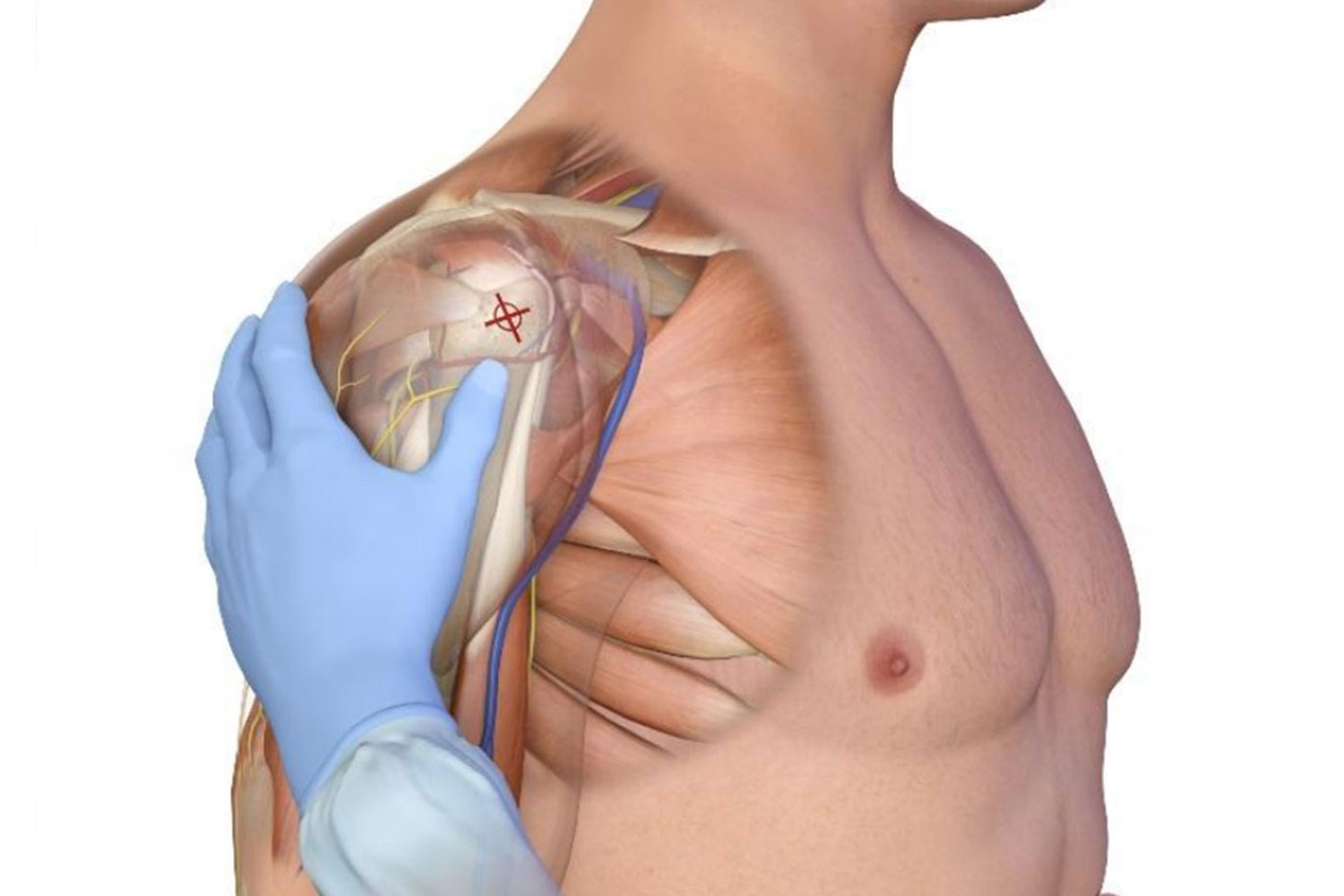 humerus-io-06-acil-al-anlar