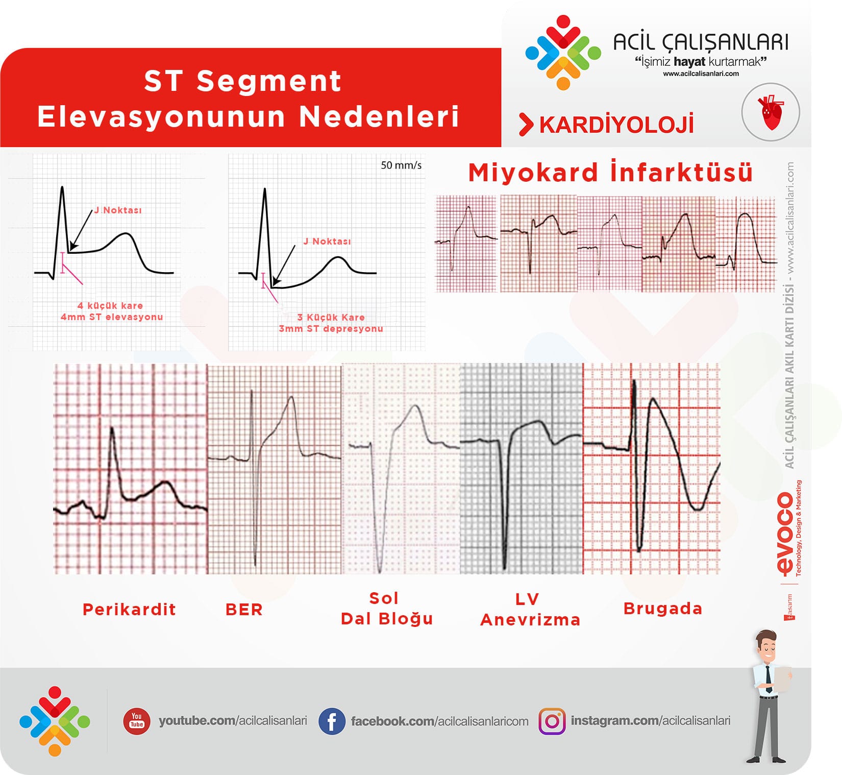 Perikardit | Acil Çalışanları