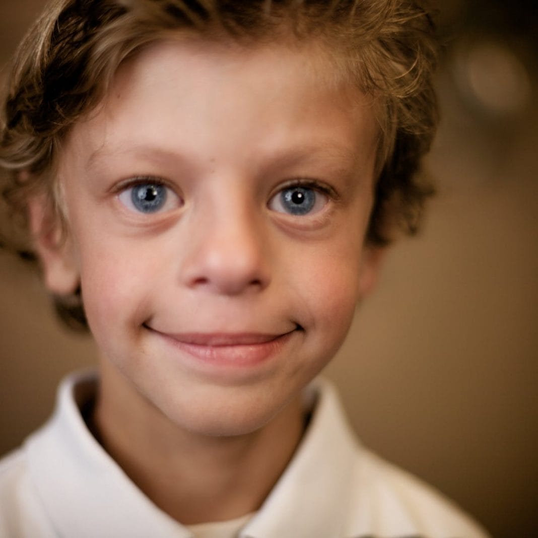 Williams – Beuren Sendromu | Acil Çalışanları