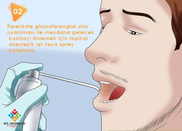 Nazogastrik Sonda (Tüp) Uygulaması | Acil Çalışanları