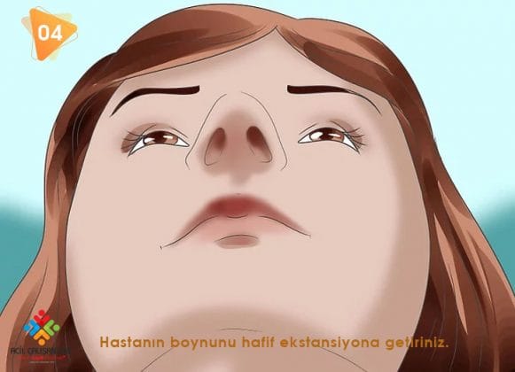 Nazogastrik Sonda (Tüp) Uygulaması | Acil Çalışanları