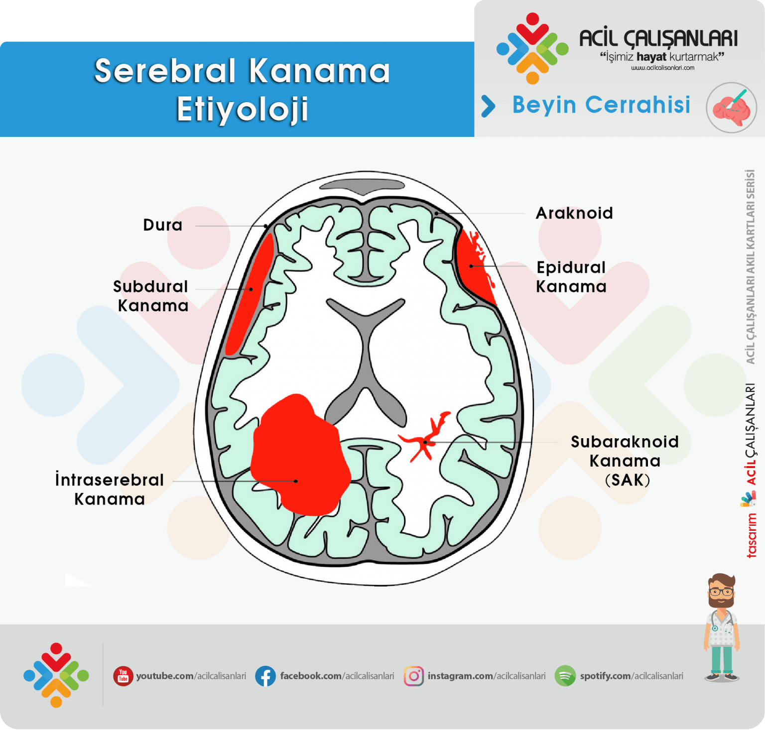 Spontan İntraserebral Kanama | Acil Çalışanları