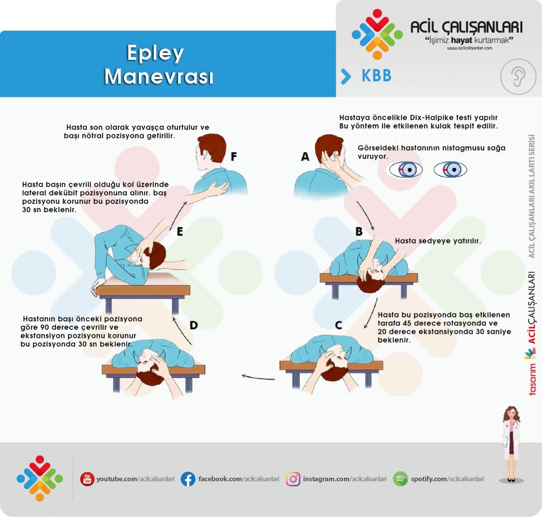 Epley Manevrası | Acil Çalışanları