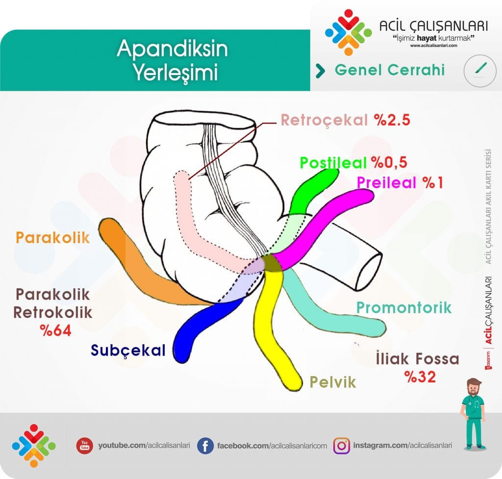 Akut Apandisit - Acil Çalışanları