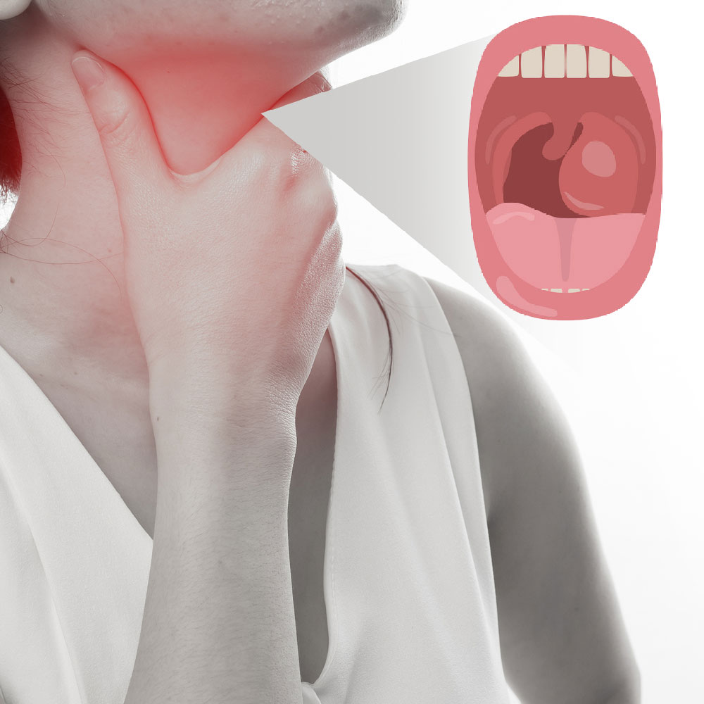 Peritonsiller Apse | Acil Çalışanları