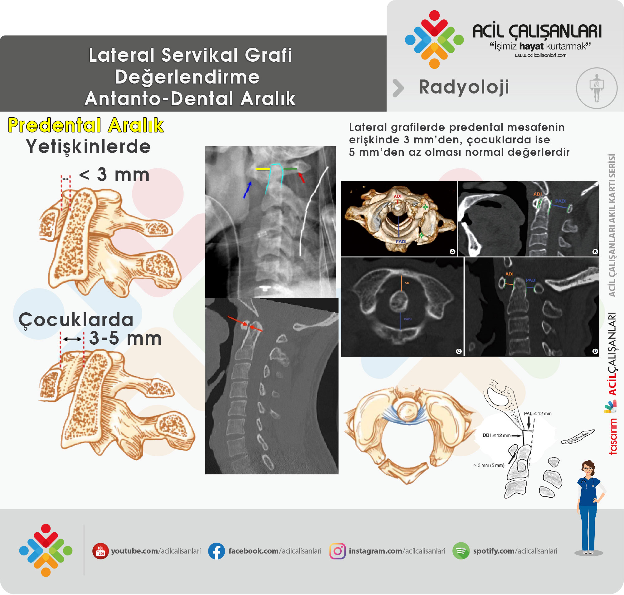 Odontoid (C2 Dens) Fraktürü - Acil Çalışanları
