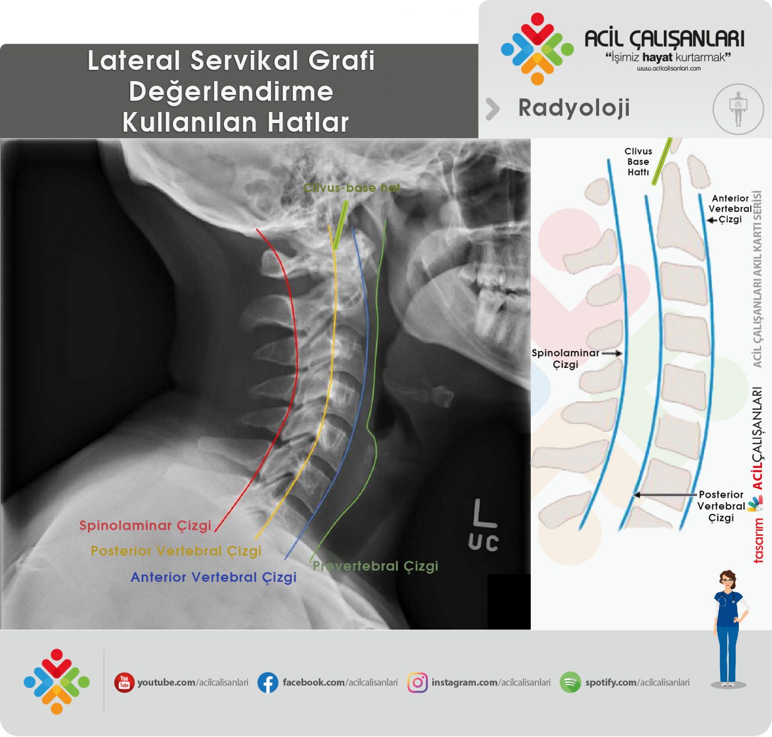 Servikal Grafi Değerlendirilmesi | Acil Çalışanları