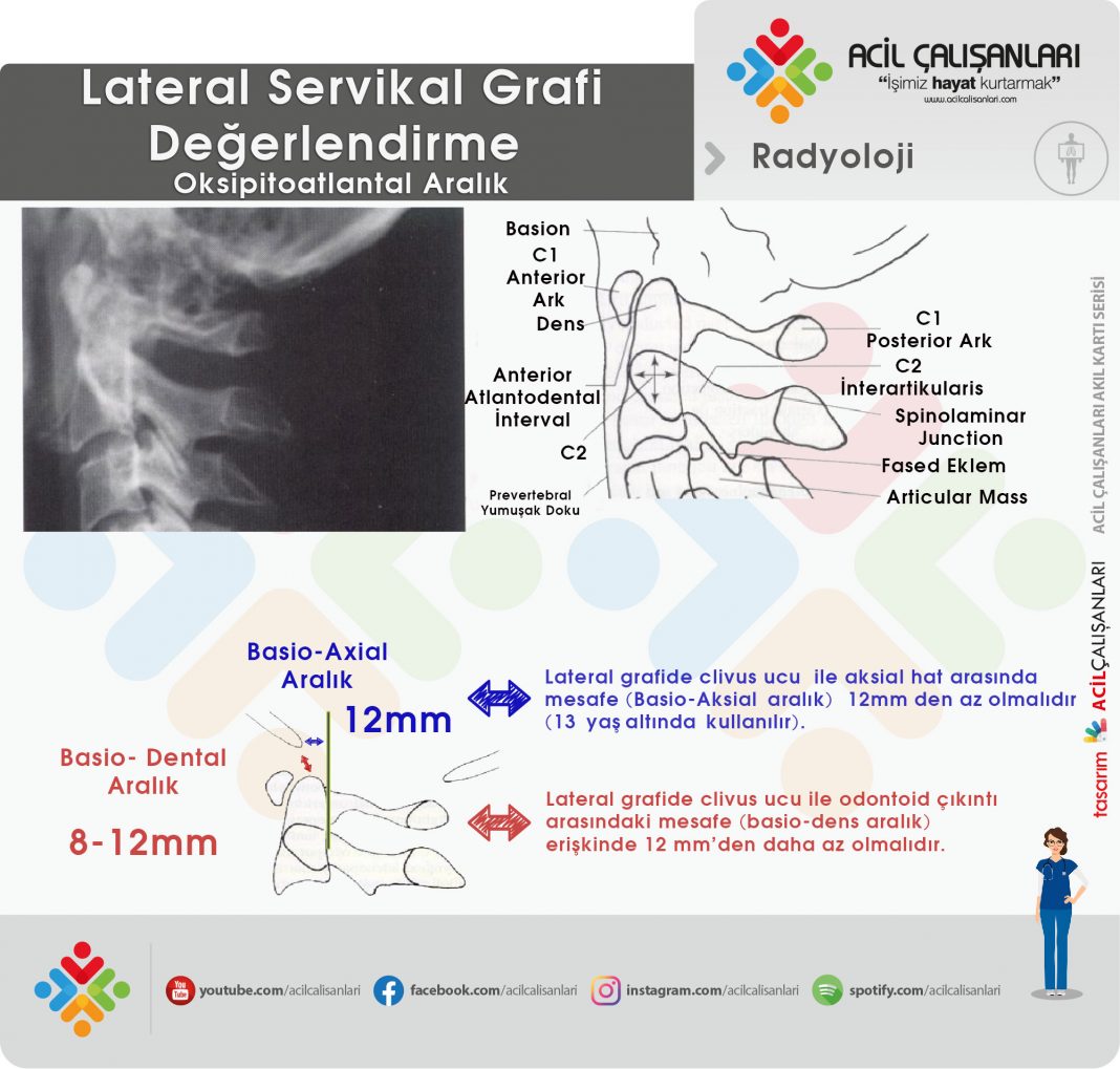 Odontoid (C2 Dens) Fraktürü | Acil Çalışanları
