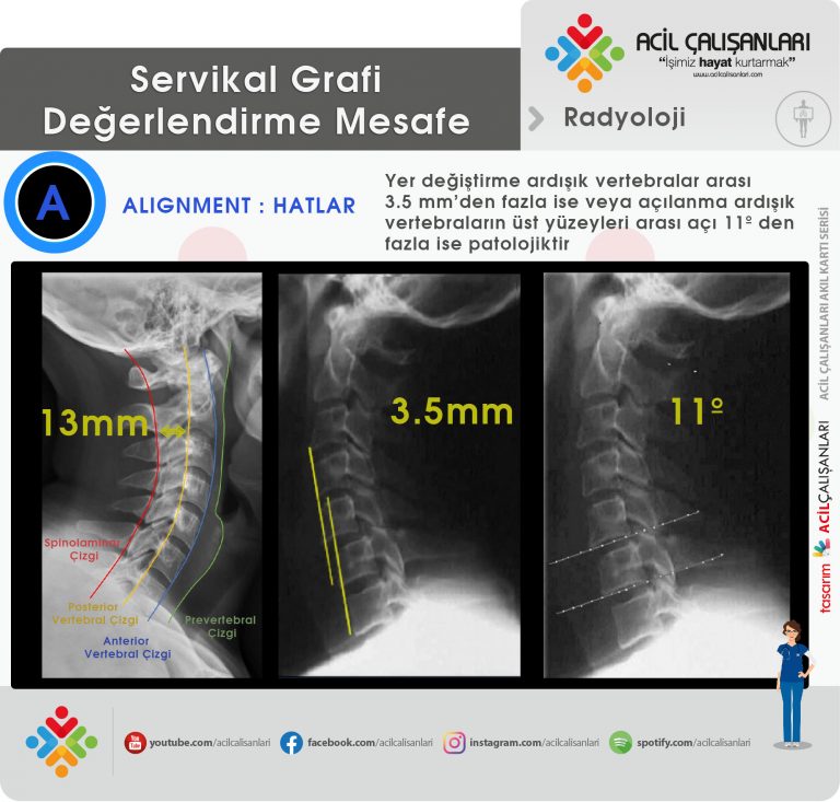 Servikal Grafi Değerlendirilmesi | Acil Çalışanları