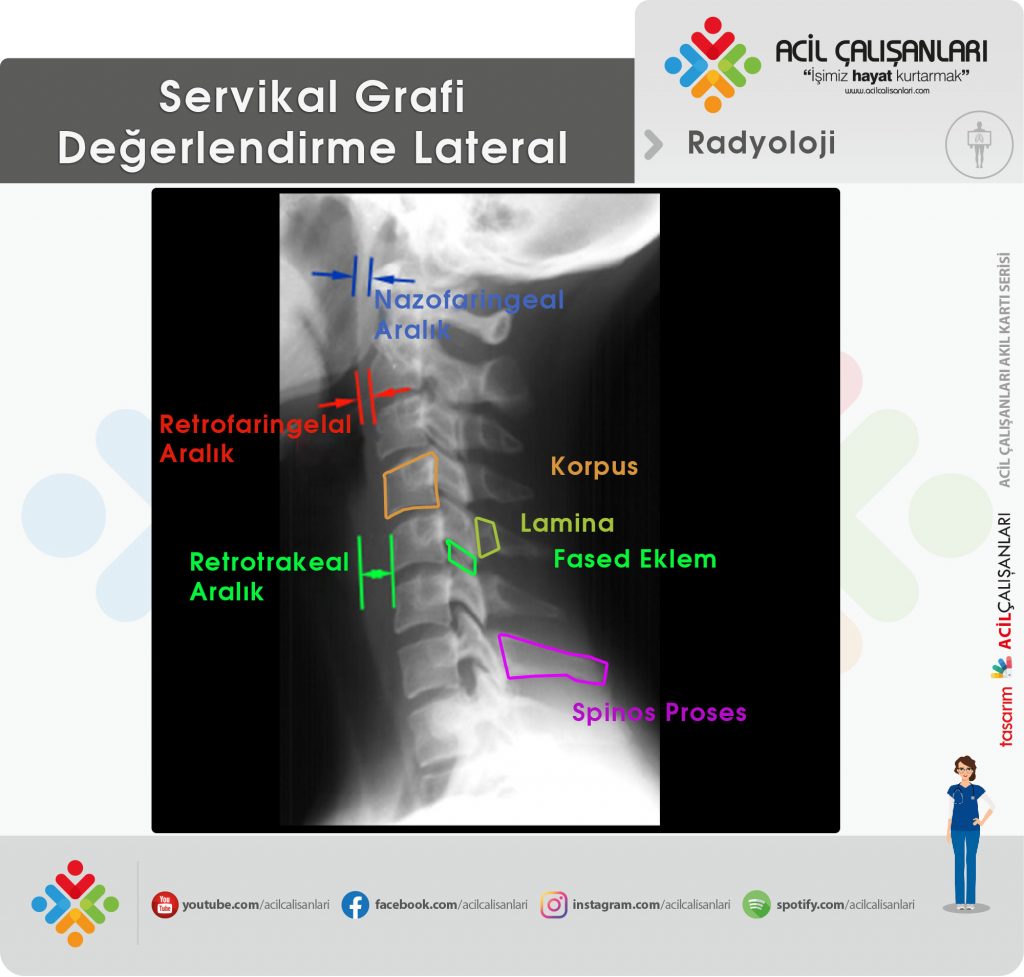 Servikal Grafi Değerlendirilmesi | Acil Çalışanları