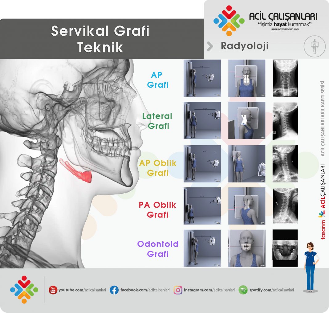 Servikal Grafi Değerlendirilmesi | Acil Çalışanları