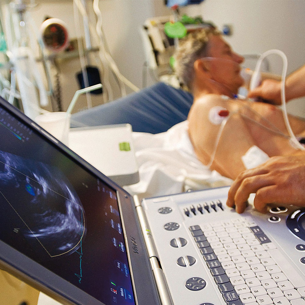 Odaklanmış Kardiyak USG (FOCUS) | Acil Çalışanları