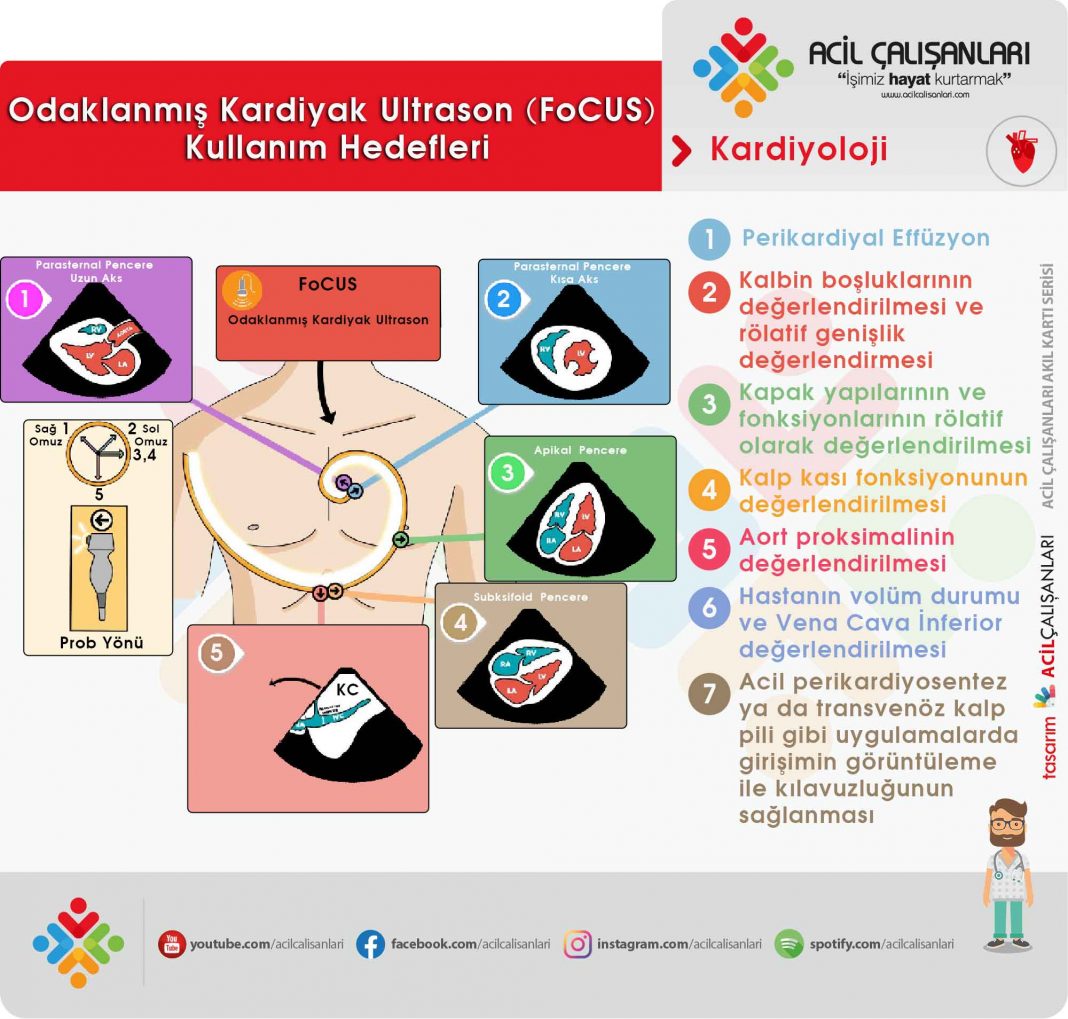 Odaklanmış Kardiyak USG (FOCUS) | Acil Çalışanları