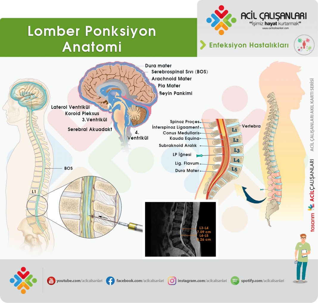 Lomber Ponksiyon (LP) - Acil Çalışanları