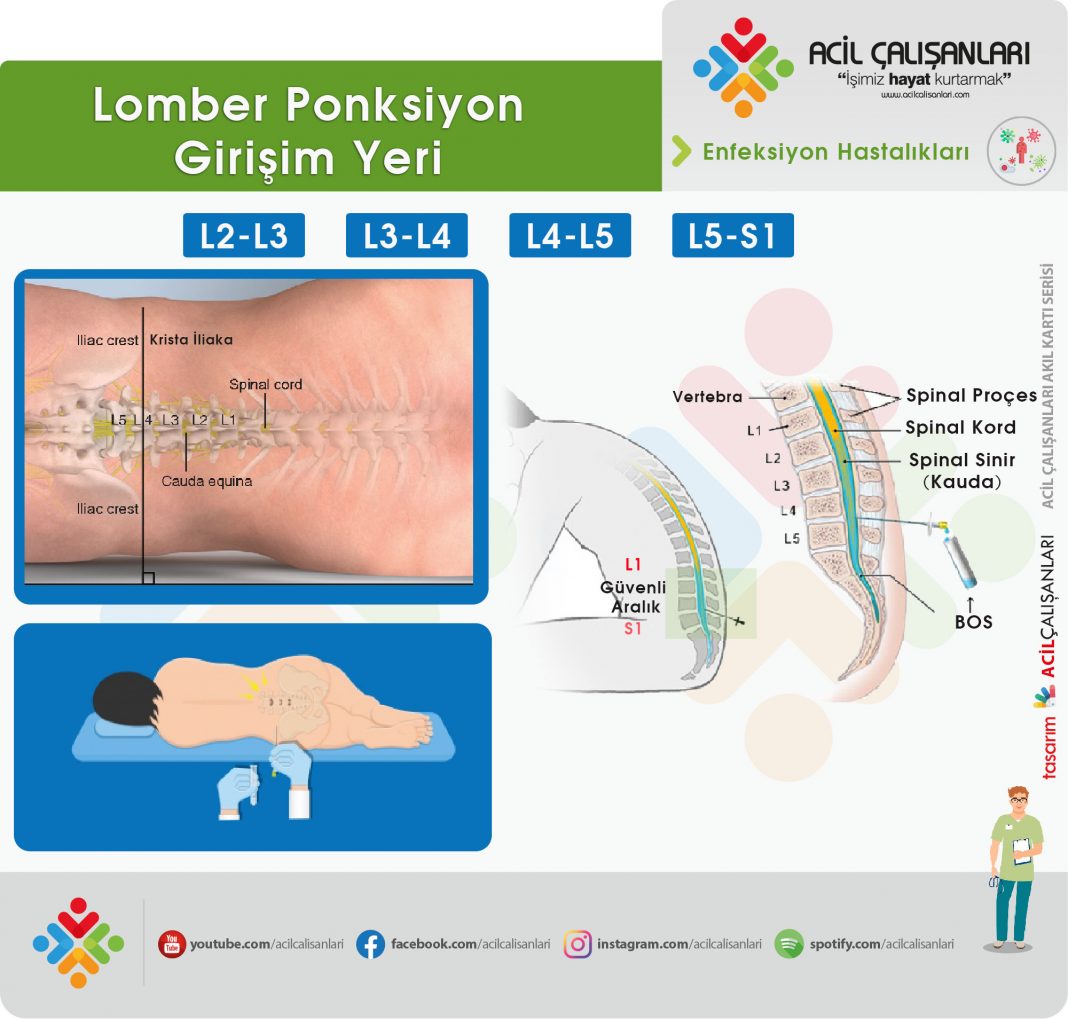 Lomber Ponksiyon (LP) - Acil Çalışanları