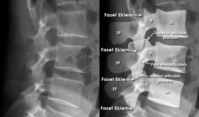 Torakal Vertebra Grafisi Değerlendirilmesi - Acil Çalışanları