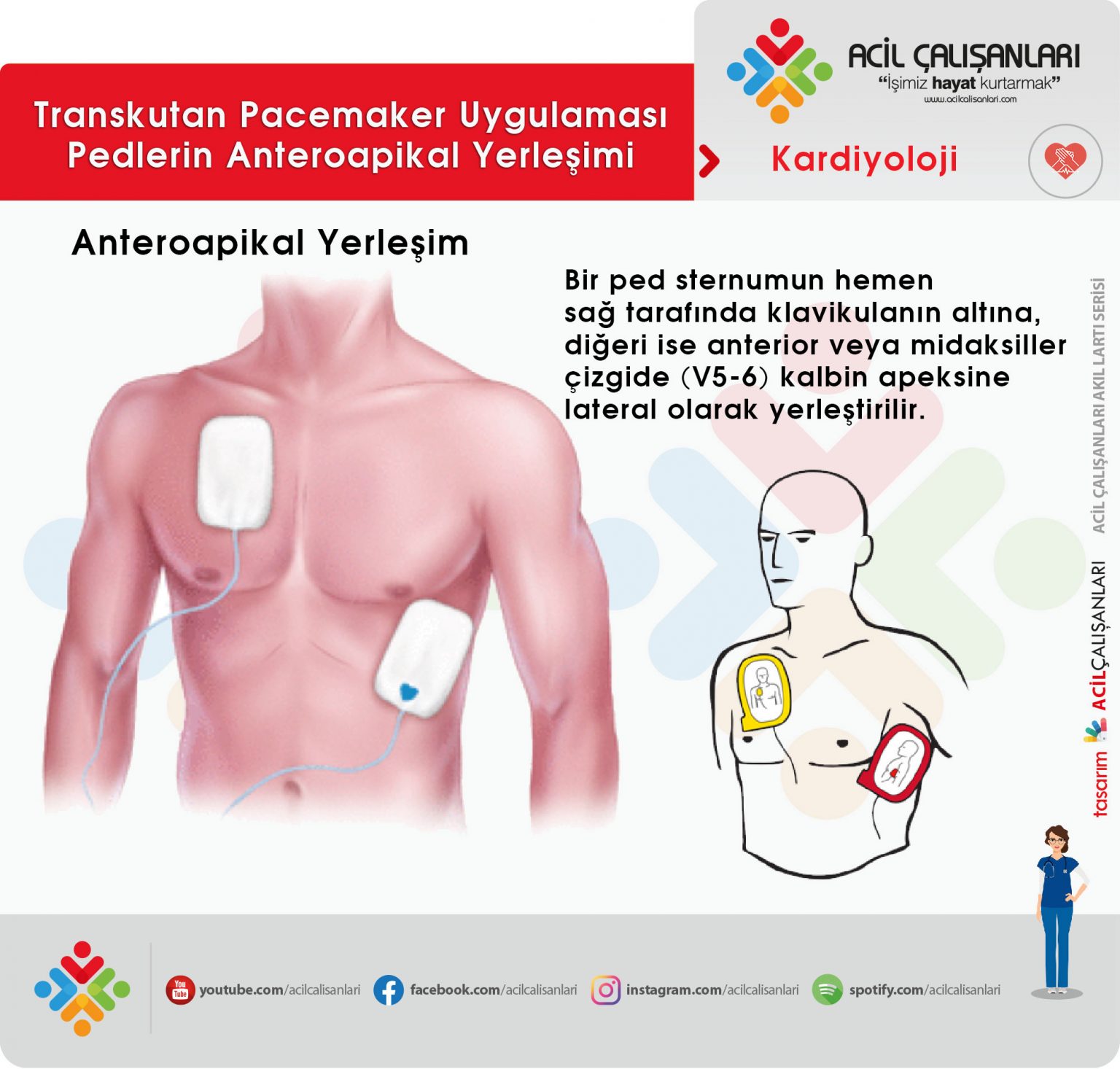 Transkutan (Eksternal) Pacemaker Uygulaması - Acil Çalışanları
