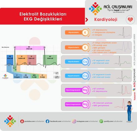 Elektrolit Bozuklukları EKG Değişimleri | Acil Çalışanları