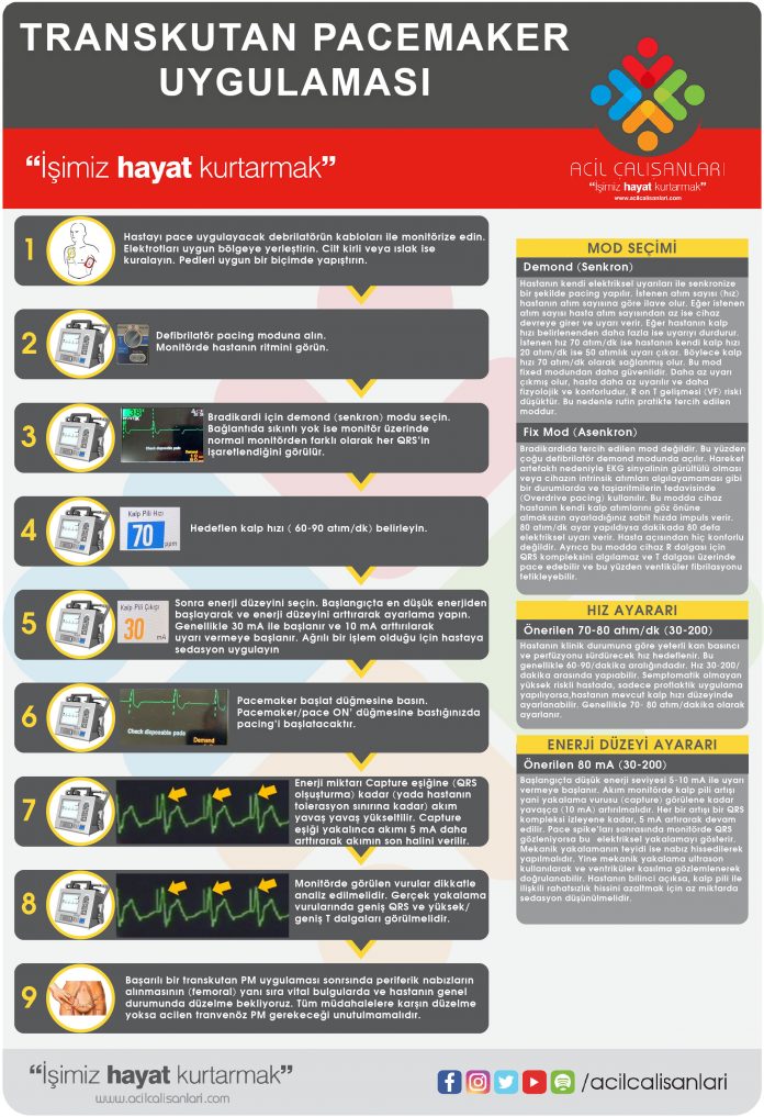 Transkutan (Eksternal) Pacemaker Uygulaması | Acil Çalışanları