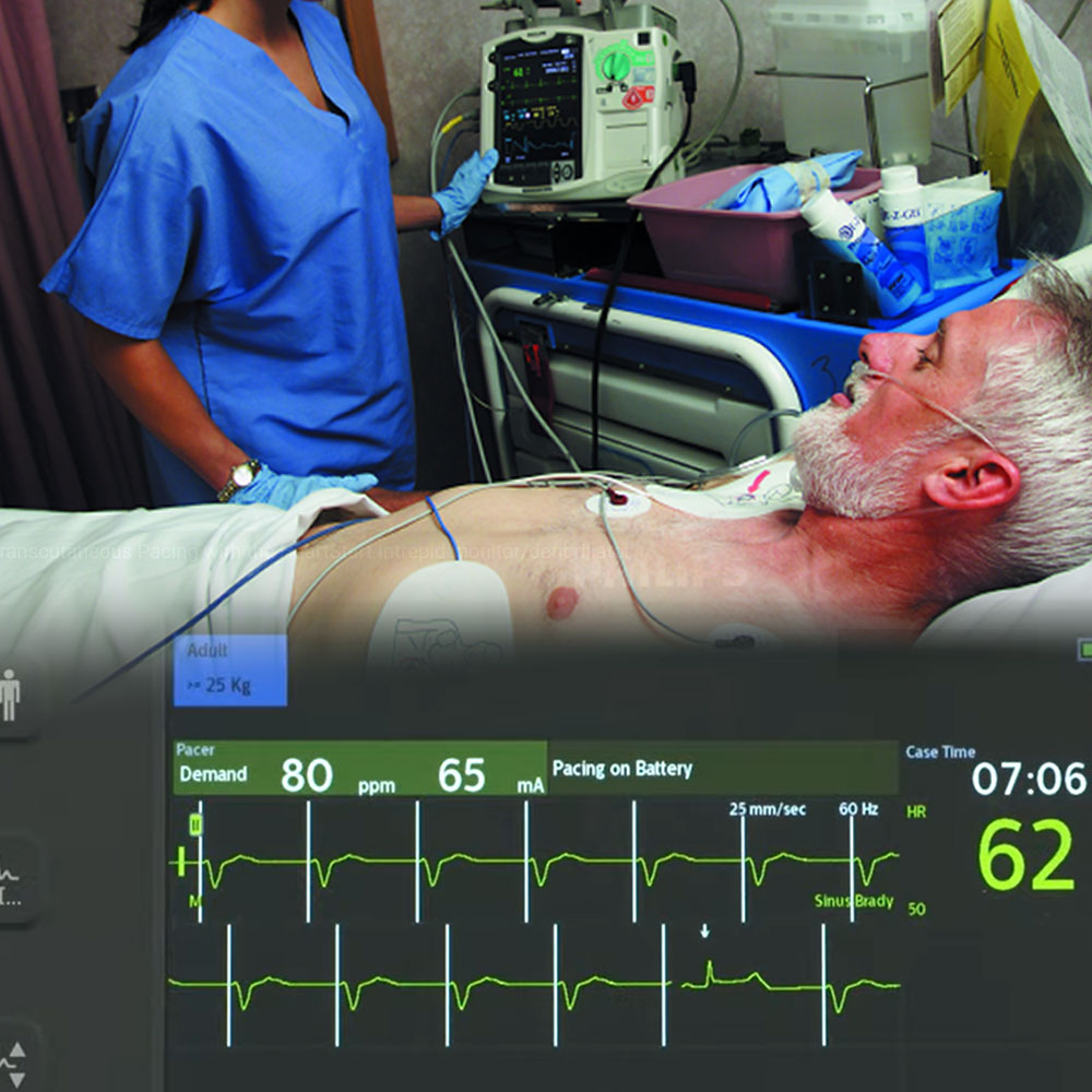 Transkutan (Eksternal) Pacemaker Uygulaması | Acil Çalışanları