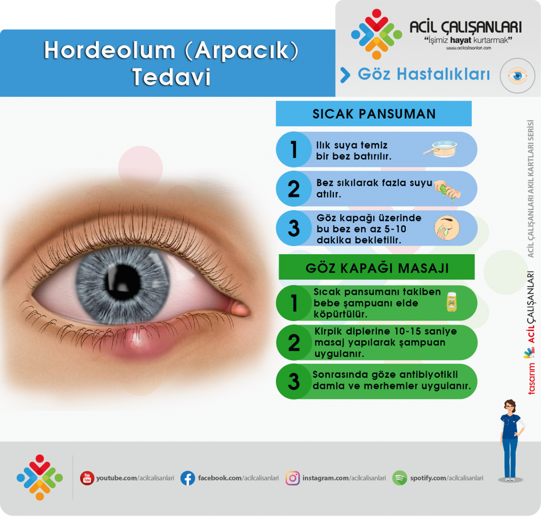 Hordeolum (Arpacık) Acil Yaklaşım | Acil Çalışanları