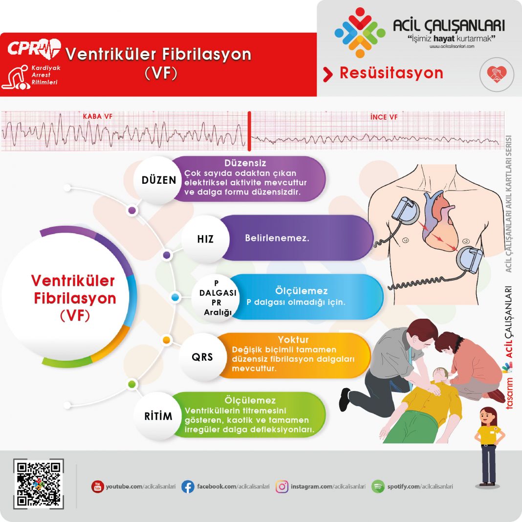 Ventriküler Fibrilasyon (VF) | Acil Çalışanları