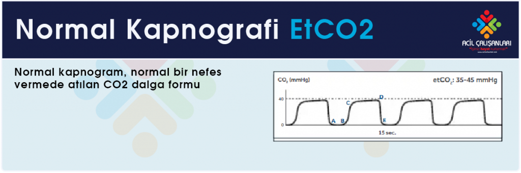 Endtidal Karbondioksit (EtCO2) Kapnografi | Acil Çalışanları