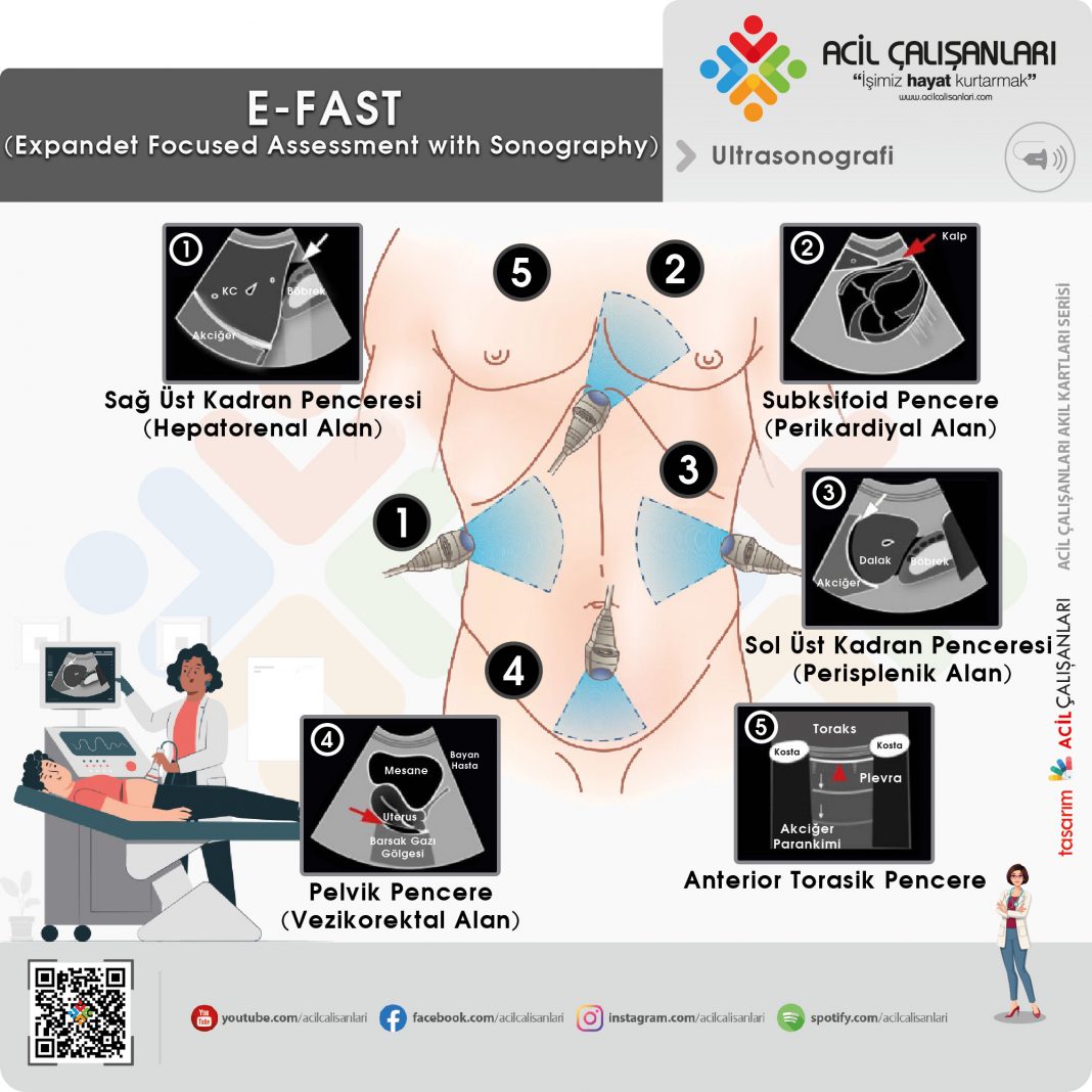 FAST / E-FAST Protokolü | Acil Çalışanları