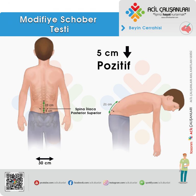 Modifiye Schober Testi | Acil Çalışanları