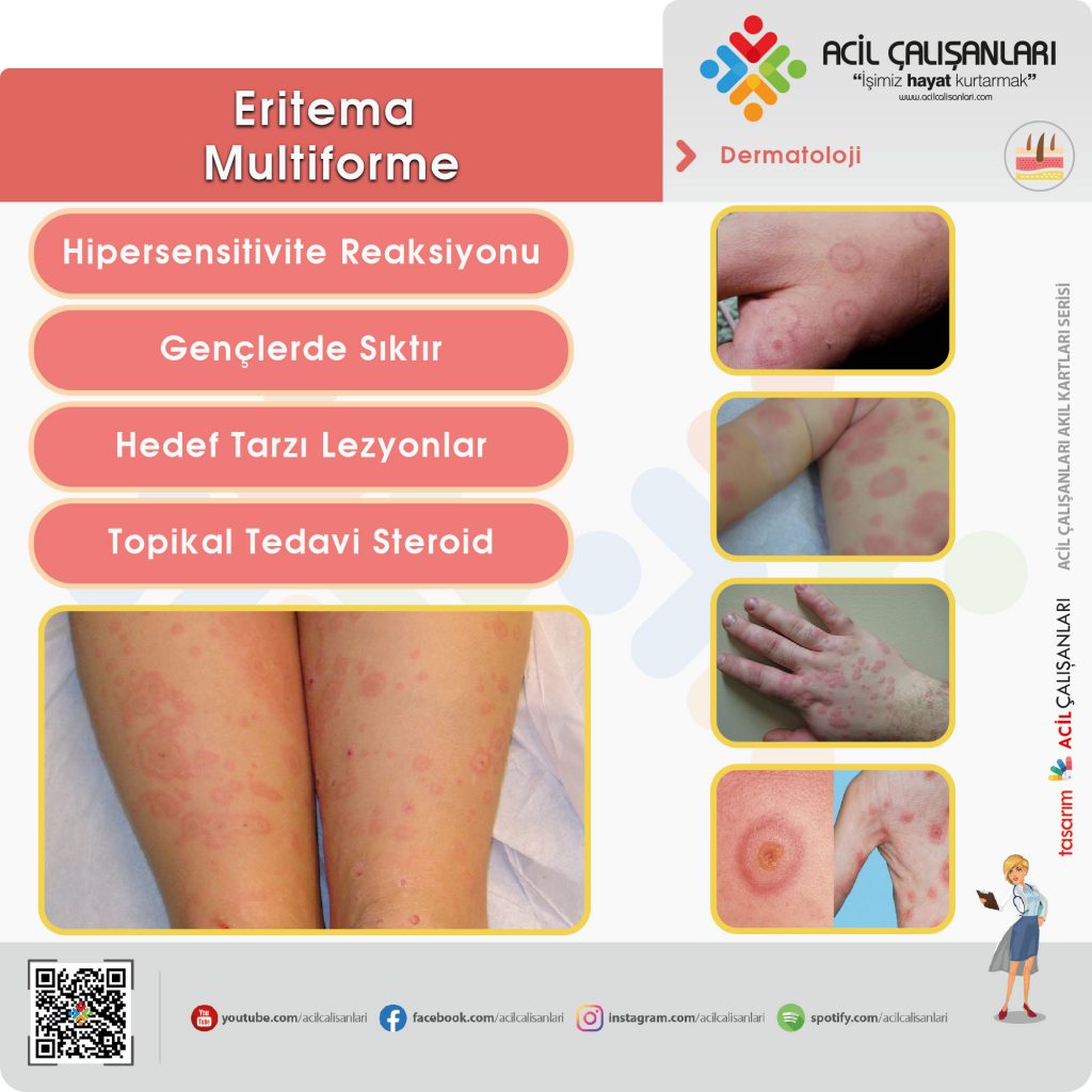 Dermatolojik Aciller | Acil Çalışanları