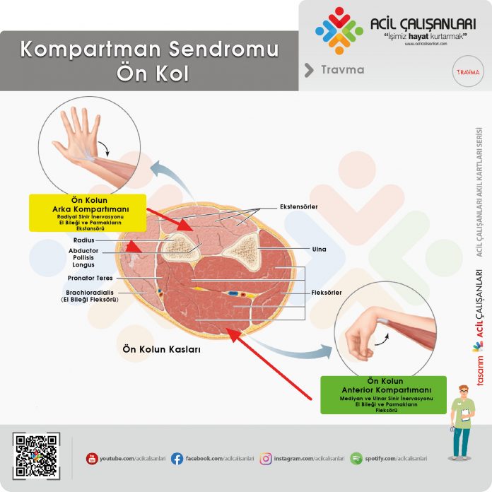Kompartman Sendromu | Acil Çalışanları