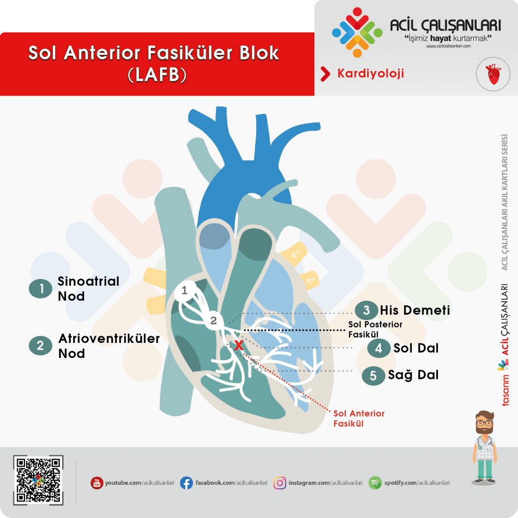 Sol Anterior Fasiküler Blok (LAFB) - Acil Çalışanları
