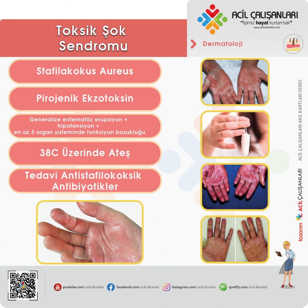 Dermatolojik Aciller | Acil Çalışanları