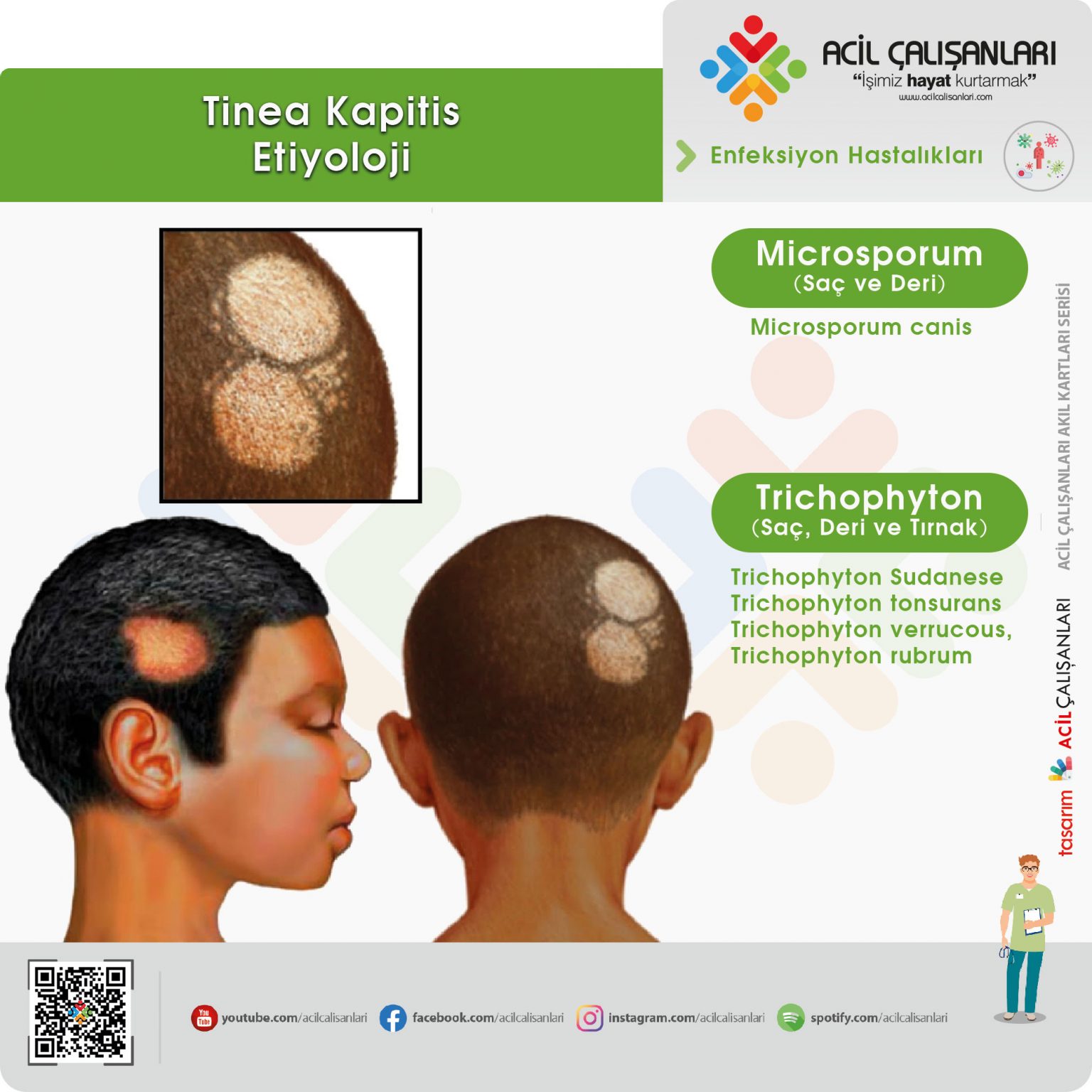 Tinea Kapitis (Saçlı Deri Mantarı) | Acil Çalışanları