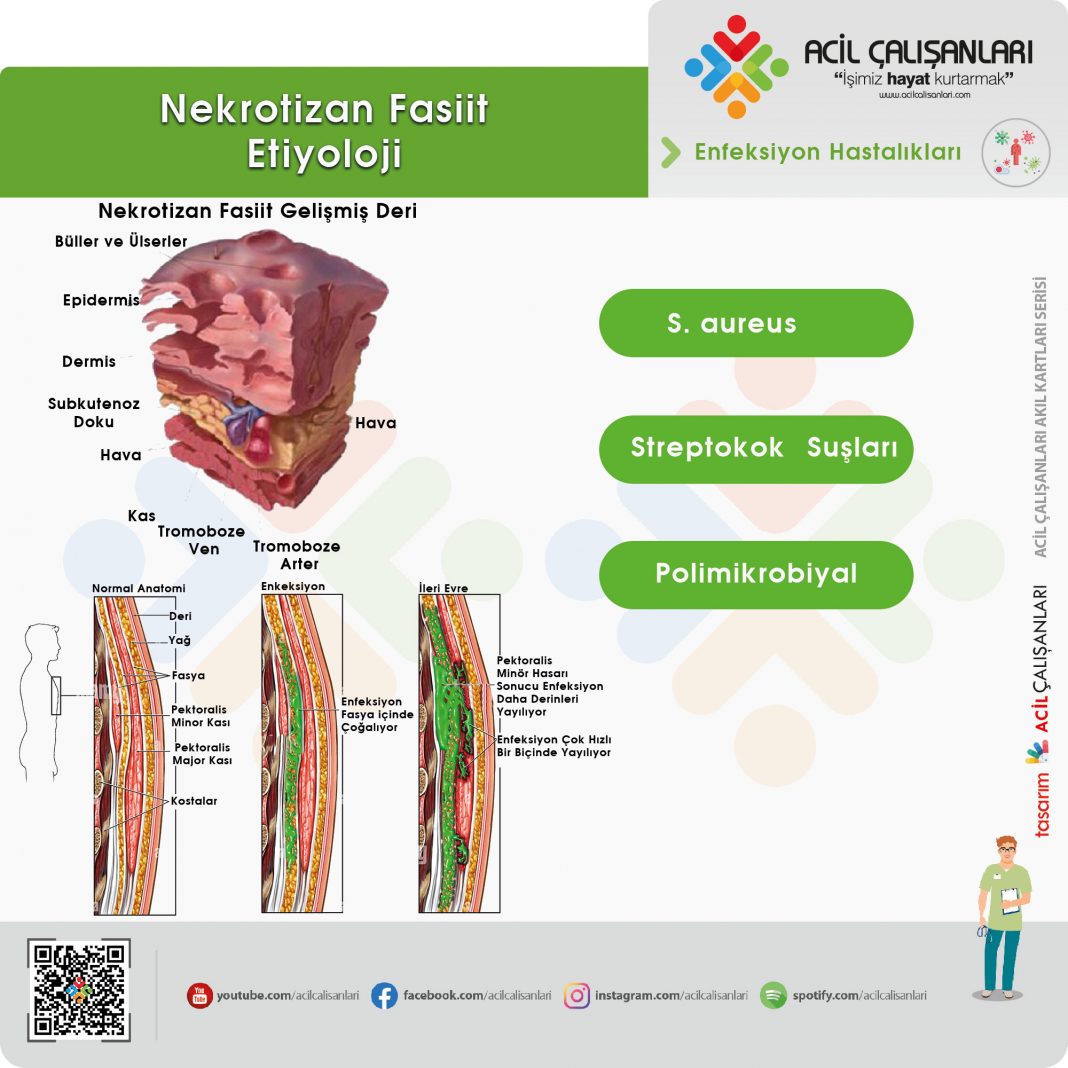 Nekrotizan Fasiit Acil Yaklaşım | Acil Çalışanları