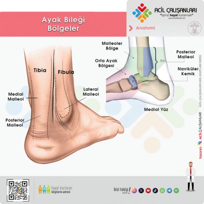 Ayak Bileği Malleol Kırıkları Acil Yaklaşımı - Acil Çalışanları