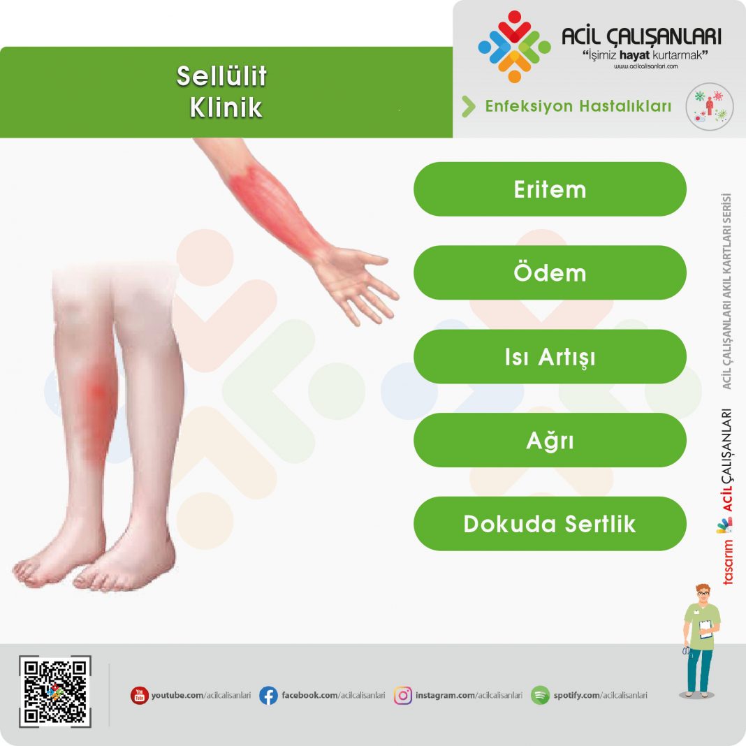 Sellülit Acil Yaklaşım | Acil Çalışanları