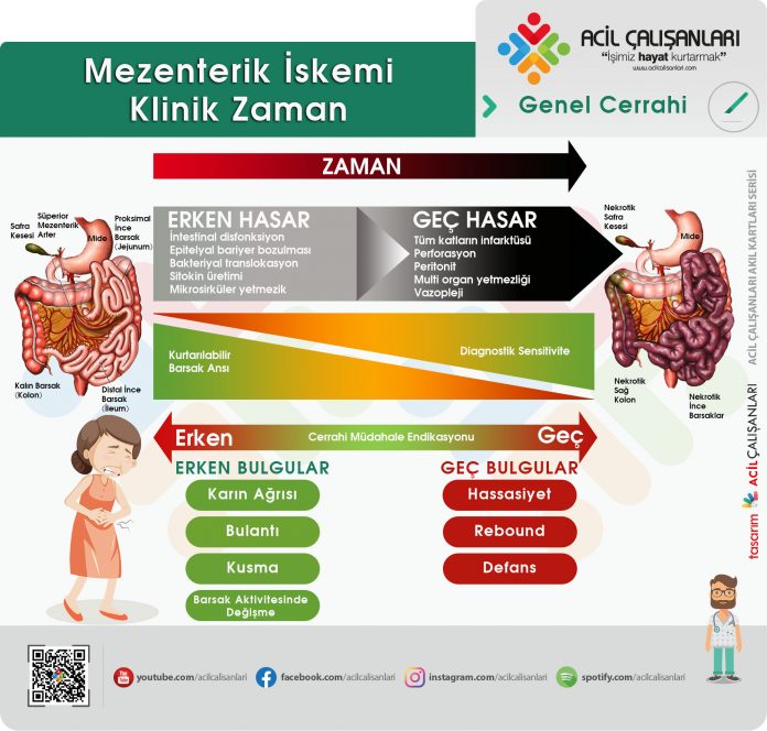 Akut Mezenterik İskemi | Acil Çalışanları