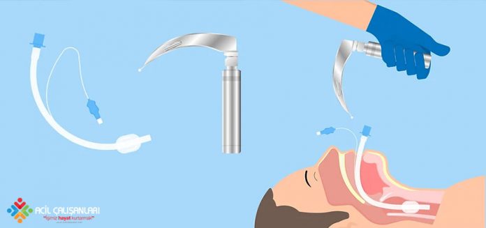 Entübasyonda Endotrakeal Tüpün Yerleşim Doğruluğu ve Derinliği - Acil ...