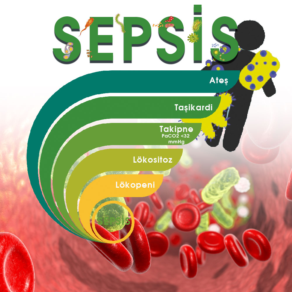 Acil Serviste Sepsis Yönetimi | Acil Çalışanları