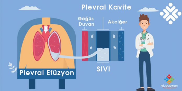 Plevral Efüzyon Acil Yaklaşım | Acil Çalışanları